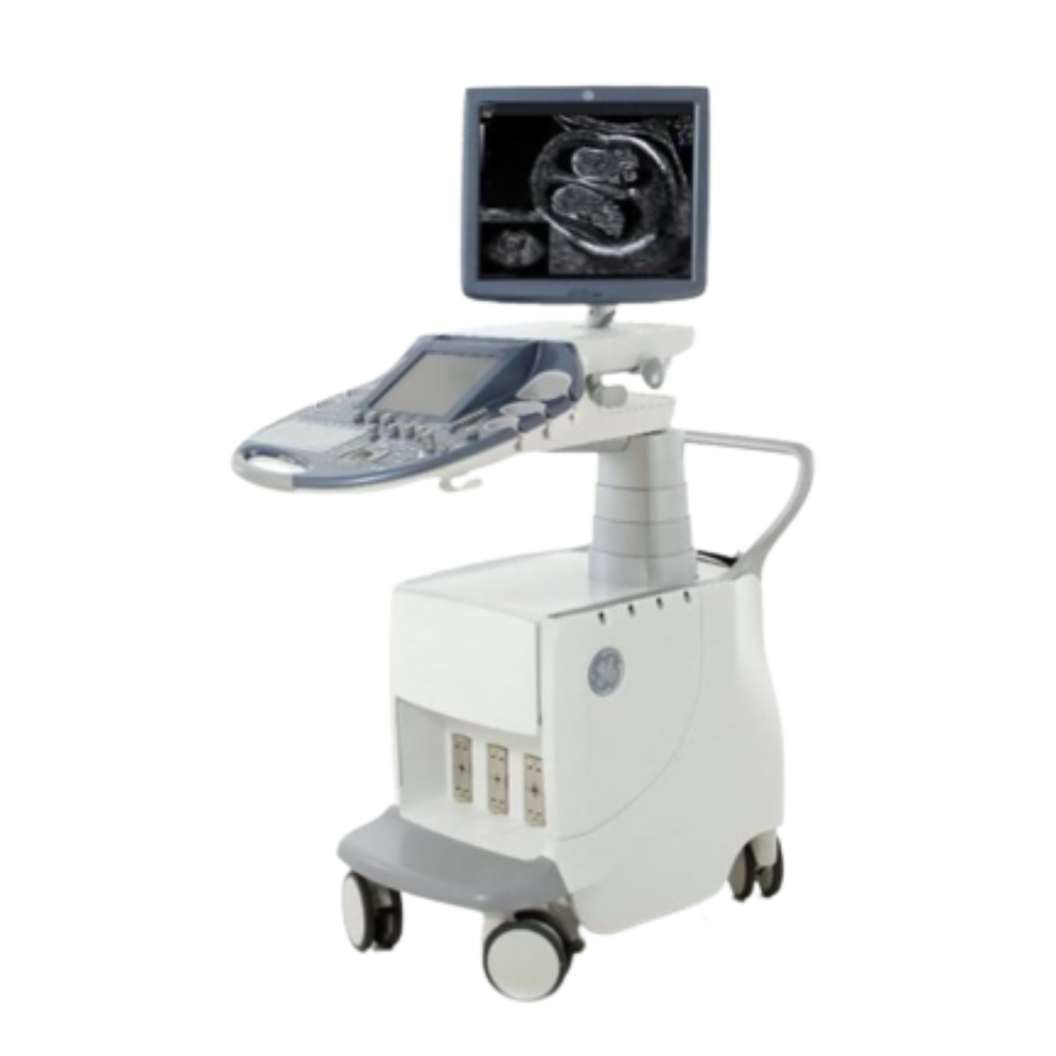Voluson E8 Ultrasound - MET Intl